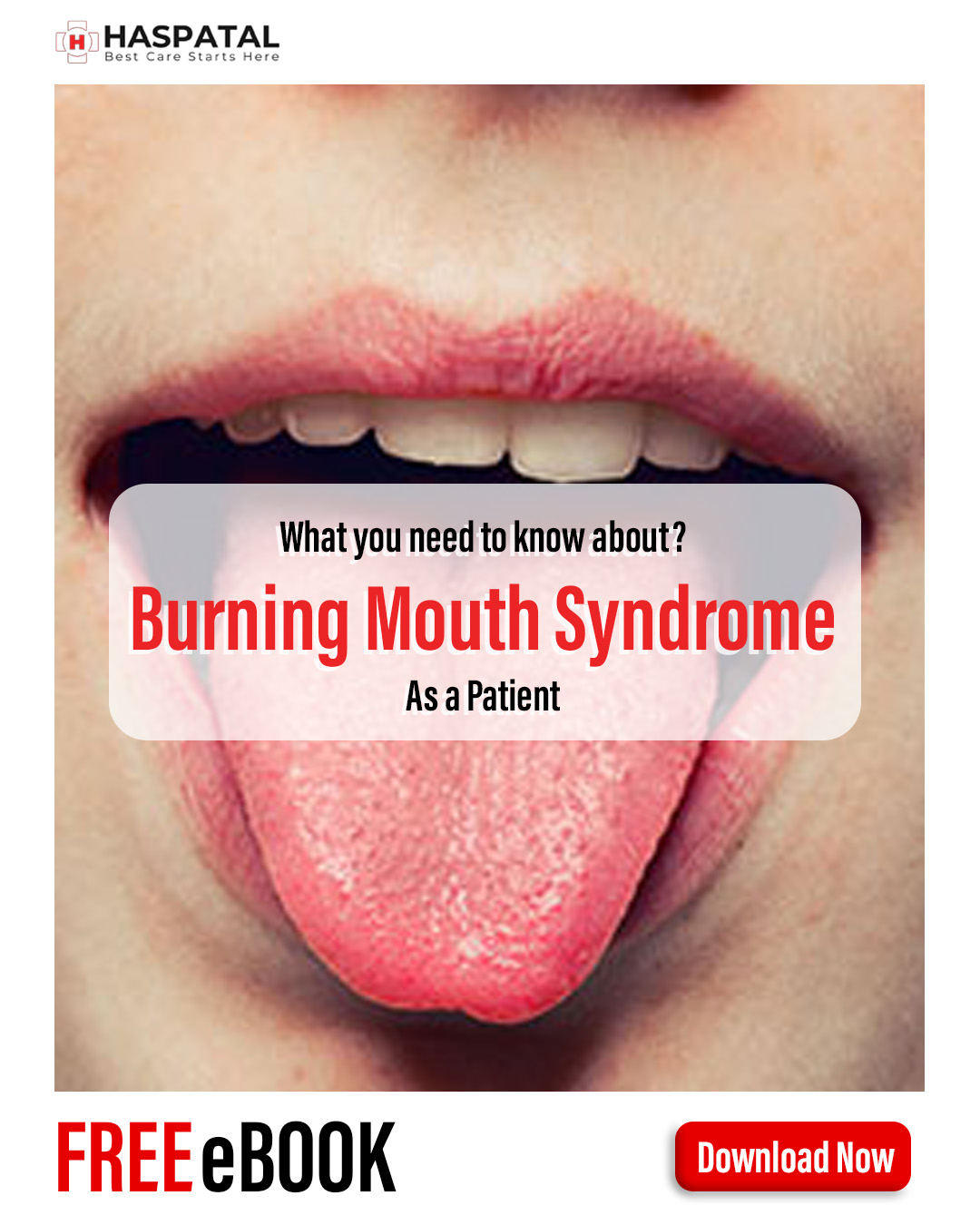 How burning mouth syndrome can affect your health? Haspatal online ...